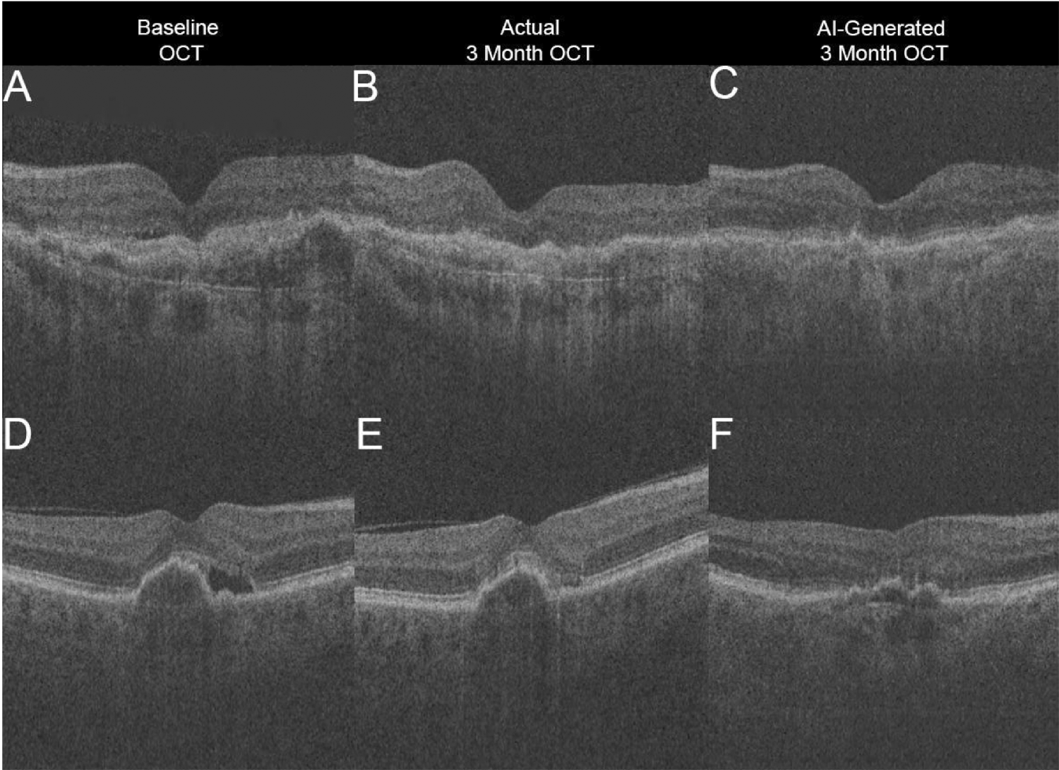 Methodological Challenges of Deep Learning in Optical Coherence ...